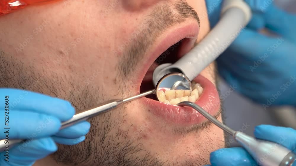 Stockvideo close-up of the open mouth of a young male patient at a ...