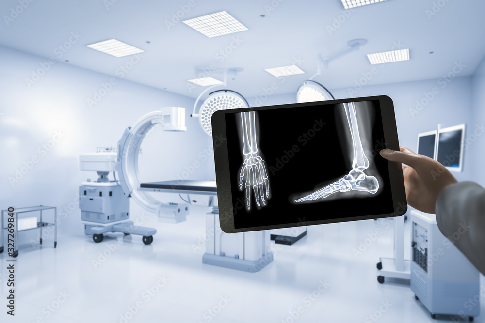 X-ray film diagnosis Stock Photo | Adobe Stock