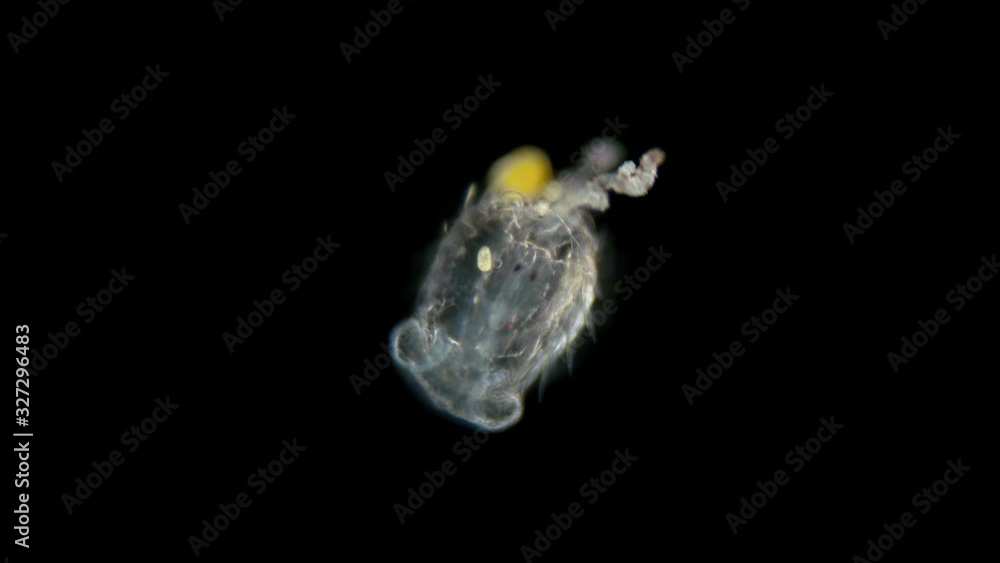 Cydippid larva under a microscope, juvenile larva, at this stage ...