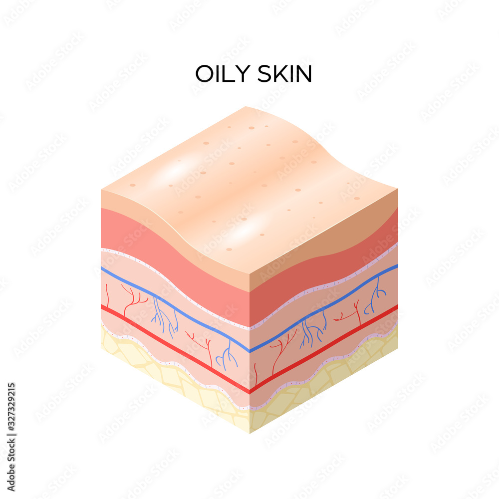 oily skin cross-section of human skin layers structure skincare medical ...