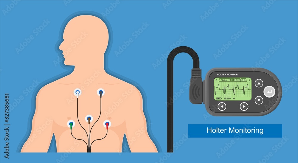 Holter monitoring system tracking cardio problem failure sick irregular ...