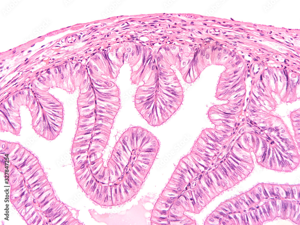 picture of histology human tissue with microscope from laboratory (not ...
