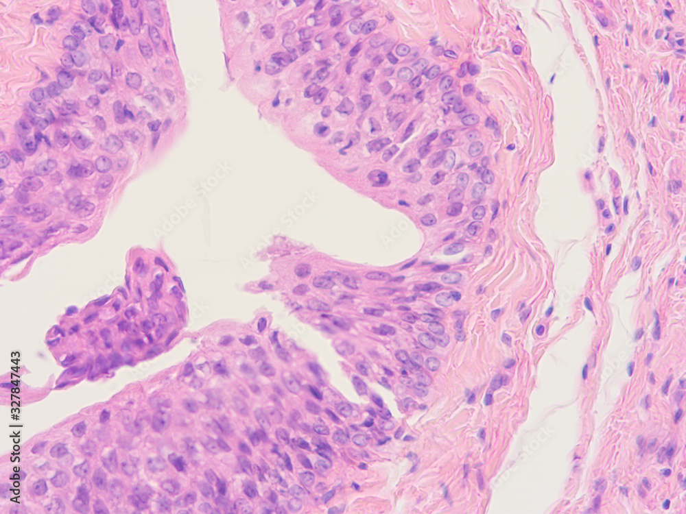 picture of histology human tissue with microscope from laboratory (not ...