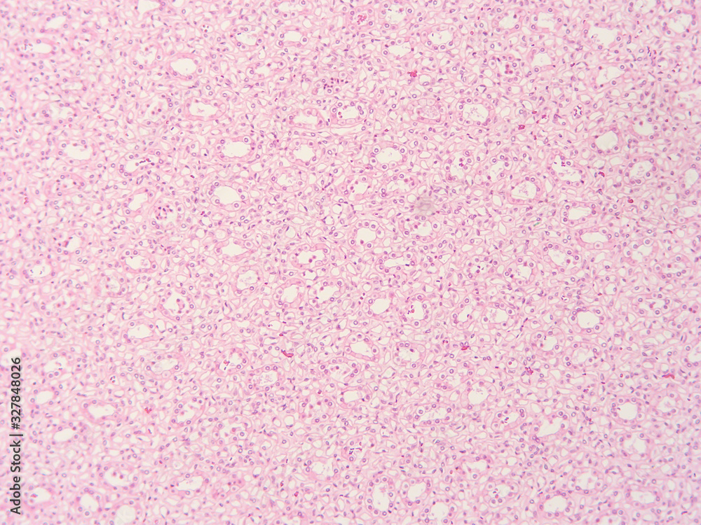 picture of histology human tissue with microscope from laboratory (not ...