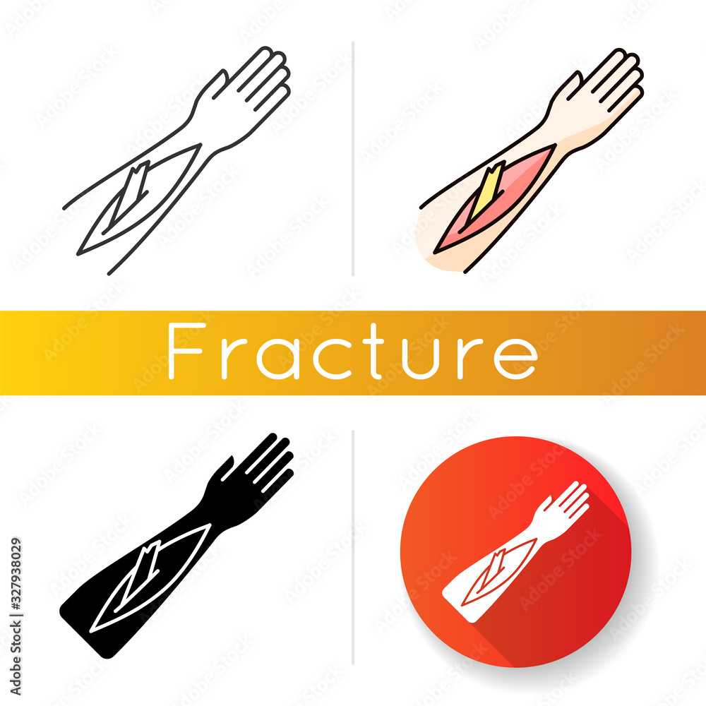Open bone fracture icon. Bone sticking out of human arm. Badly injured ...