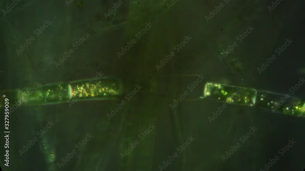 Pyrenoids of chloroplasts glow when observed with polarization ...