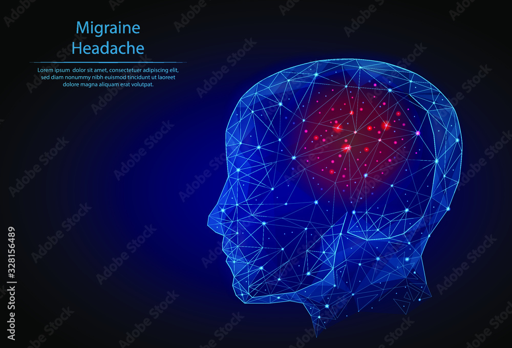 Abstract image Headache in the form of a starry sky or space ...