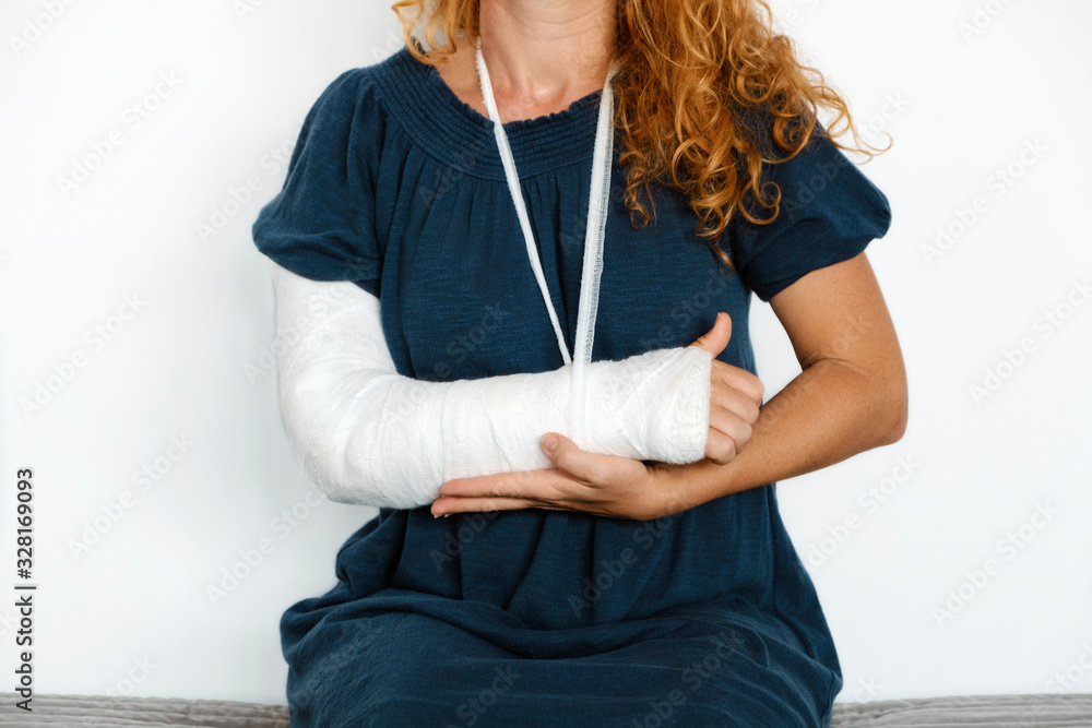 Broken arm in a cast and bandage young red-haired woman sits on bed in ...