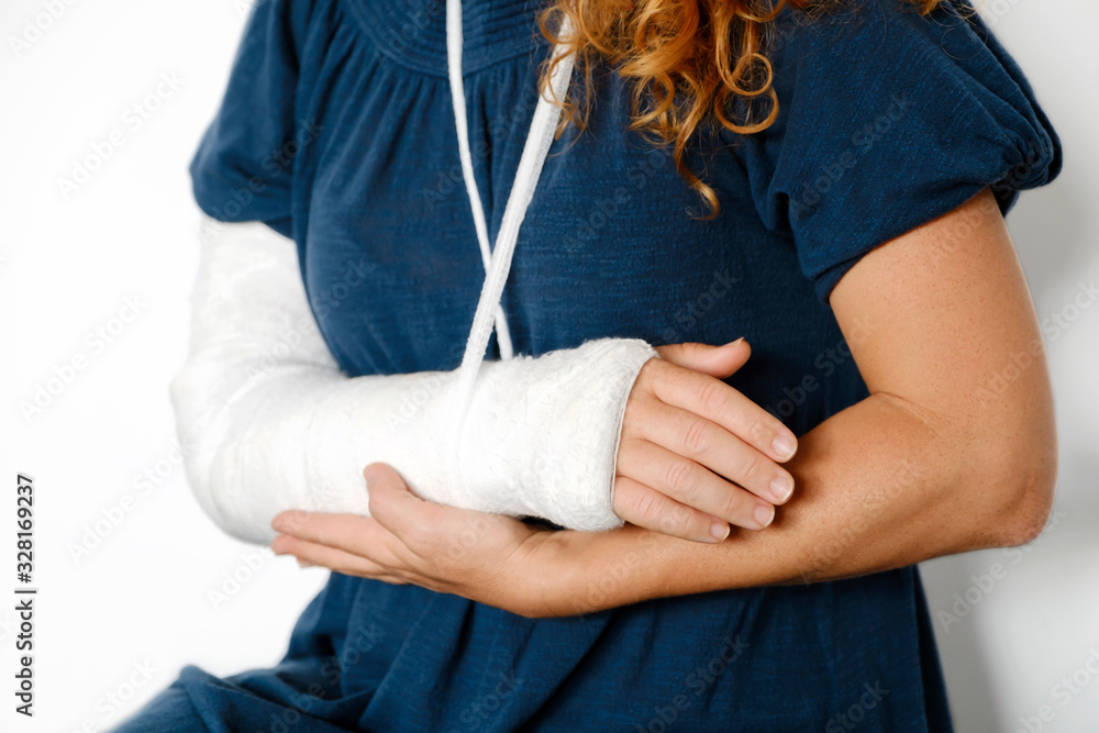 Broken Hand Cast Girl