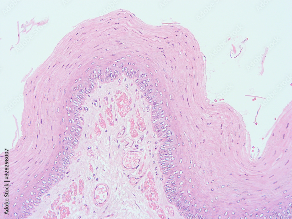 picture of histology human tissue with microscope from laboratory (not ...