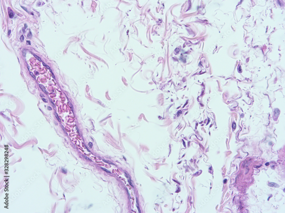 picture of histology human tissue with microscope from laboratory (not ...