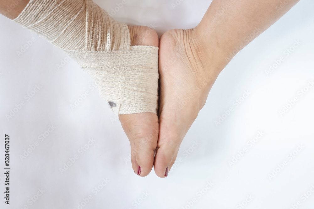 Woman's leg with sprained ankle with elastic bandage isolated on white ...
