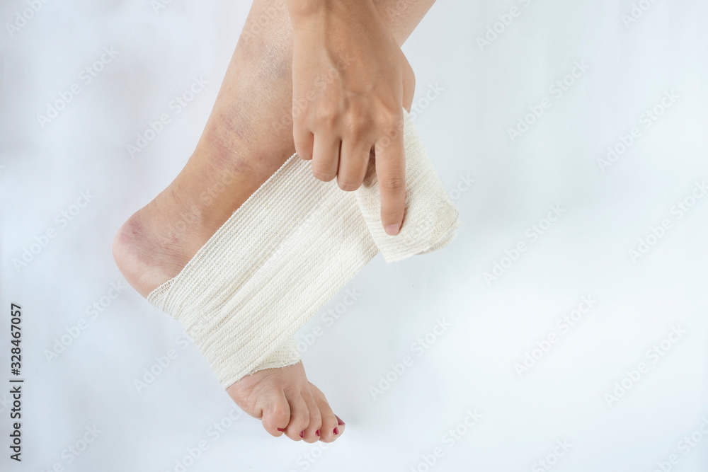 Woman is wrapping her leg with sprained ankle with elastic bandage ...