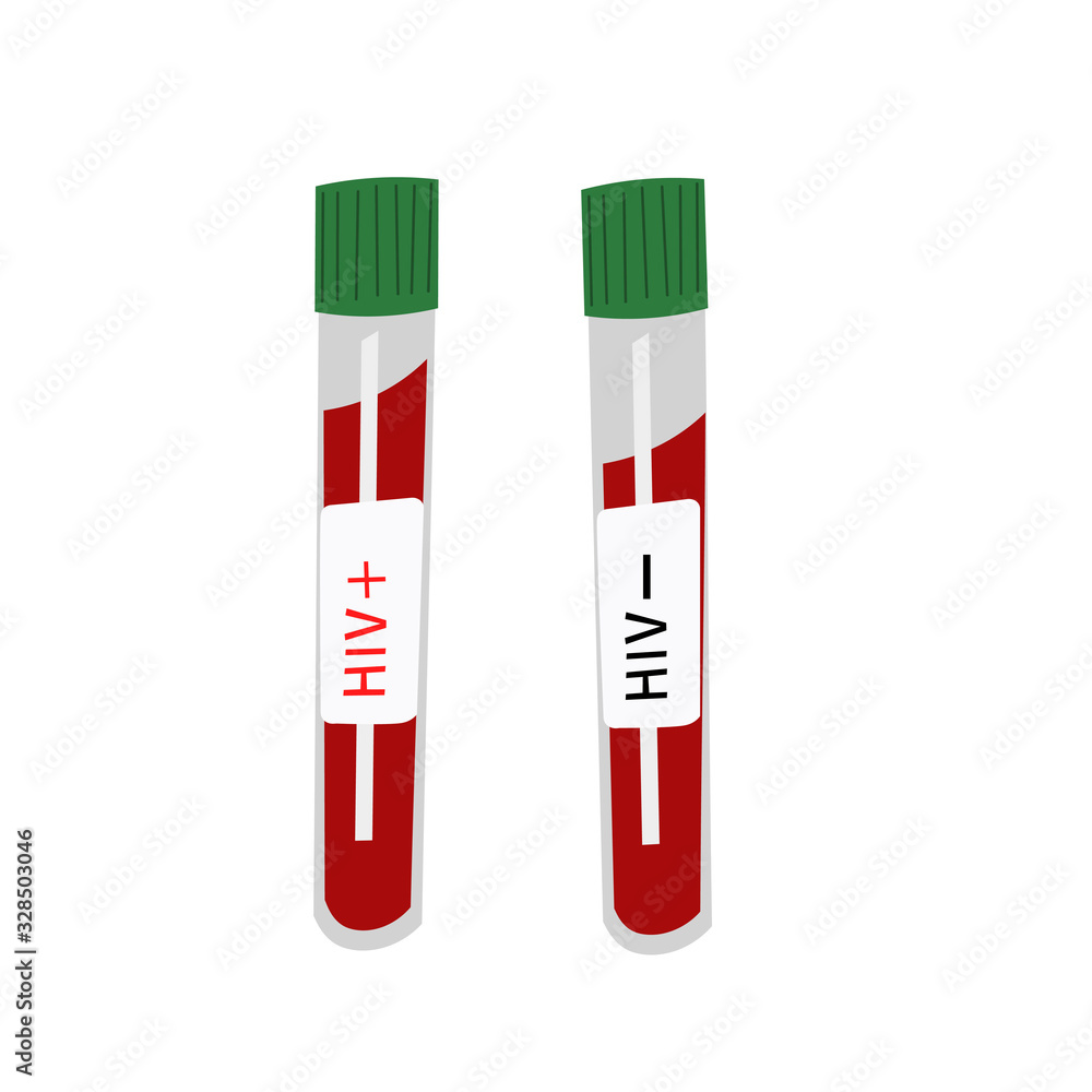 HIV positive and negative test two tube with blood a symbol of World ...