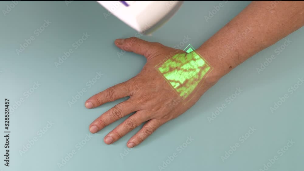 A laboratory technician utilizing a vein scanner apparatus to visualize ...