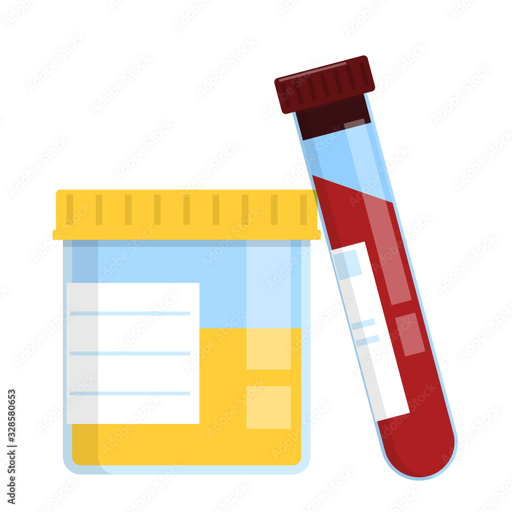 Blood and urine samples vector isolated. Medical analysis Stock Vector ...
