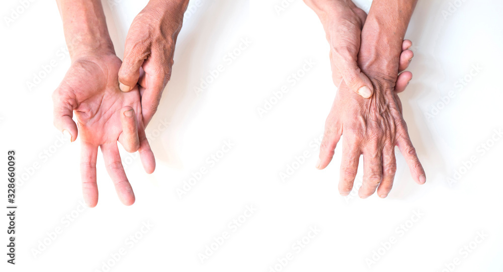 Rheumatoid arthritis and hand and finger muscles of elderly men with ...