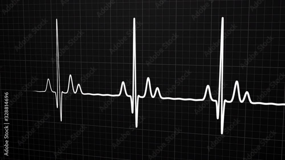 Loopable: White 3D EKG/ECG cardiogram oscilloscope monitor heartbeat ...