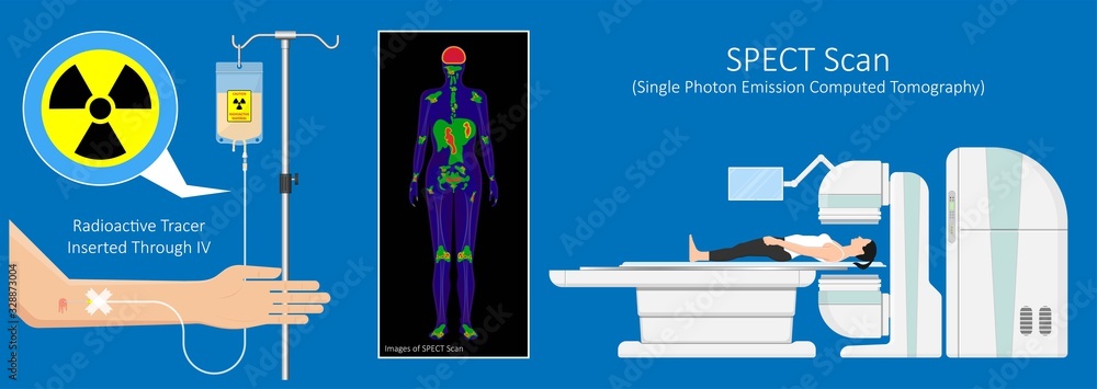 SPECT scan radiologist single computed image CT PET 3D radiotracer ...