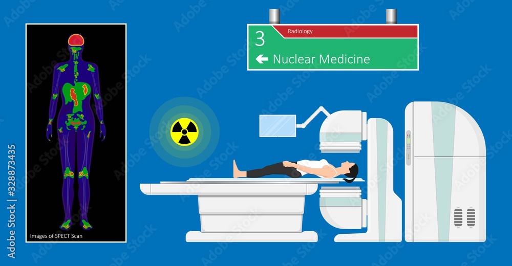 SPECT scan radiologist single computed image CT PET 3D radiotracer ...