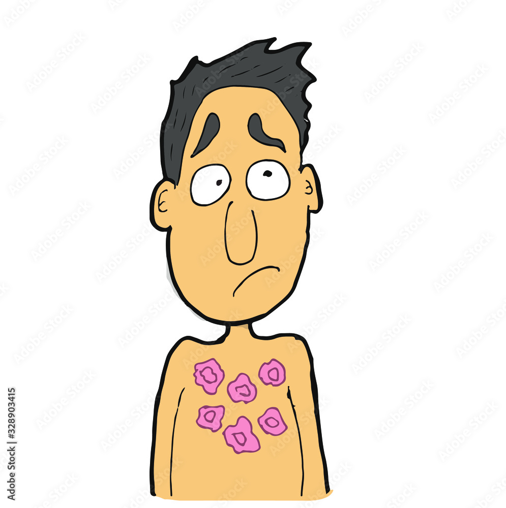 skin condition. ringworm. cartoon vector. Stock Vector | Adobe Stock
