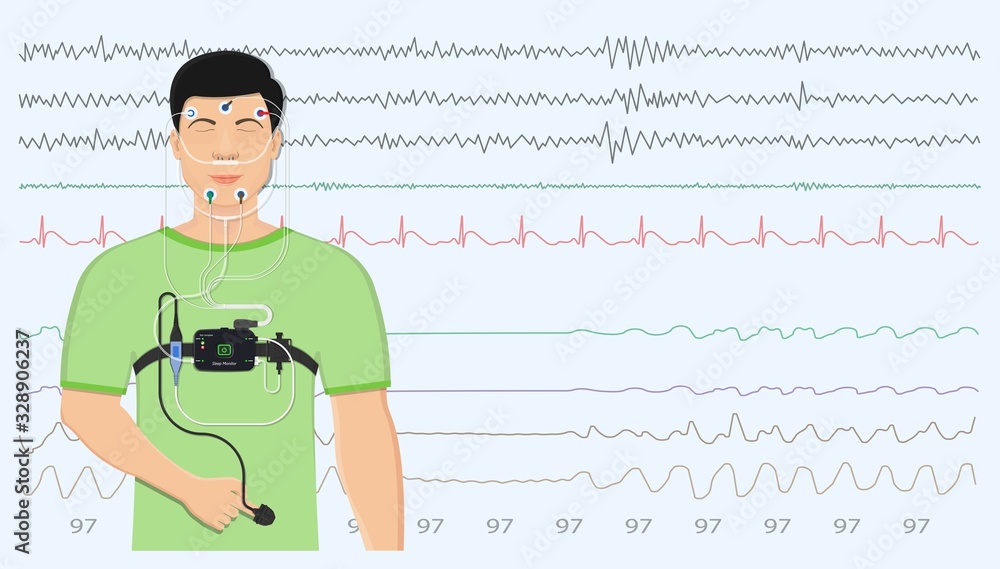 PSG sleep study test apnea diagnose Periodic limb movement disorder ...