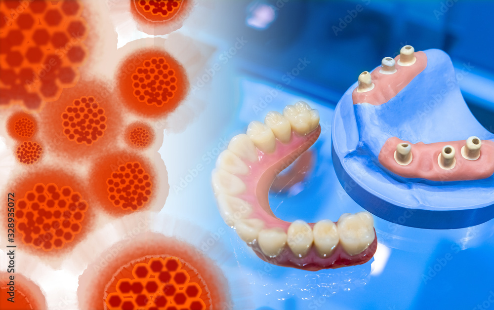 Denture next to the image of infection. The symbol of the virus ...