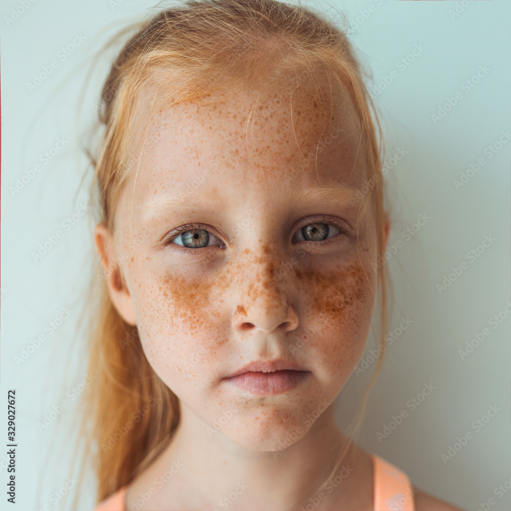 Little ginger girl with pigment on her face and freckles. Children's ...