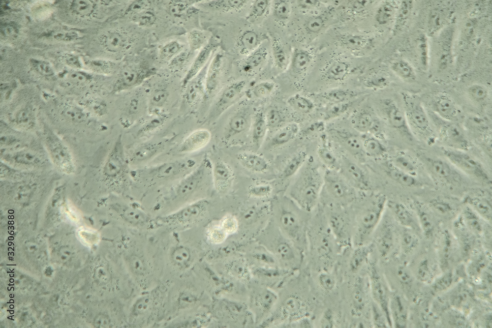 Human cancer cells under microscope background texture Stock Photo ...