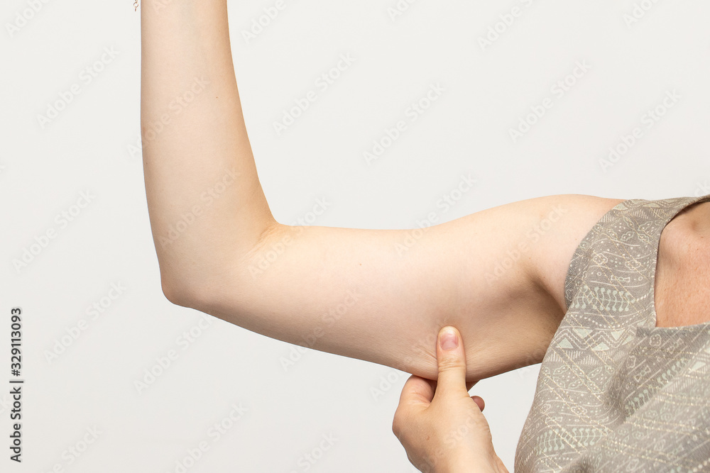 Woman pinching the flabby muscle and unwanted excess skin under her arm ...