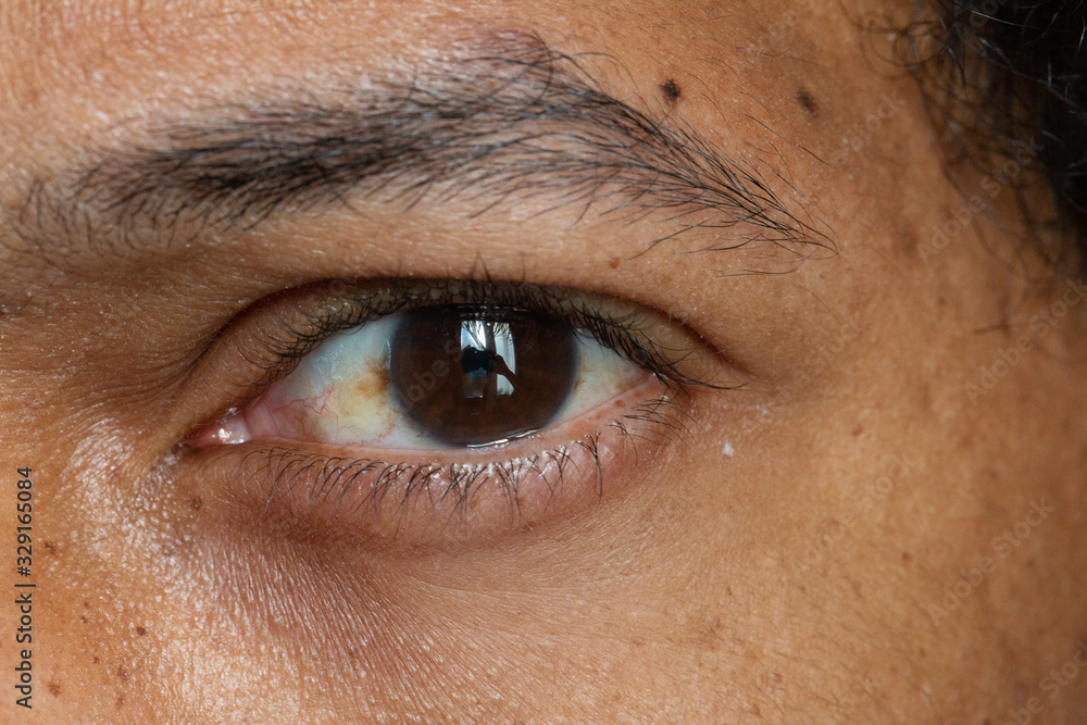 Latin Readability sew eye pigmentation spots stockings effort Skim Latin Readability sew eye pigmentation spots stockings effort Skim