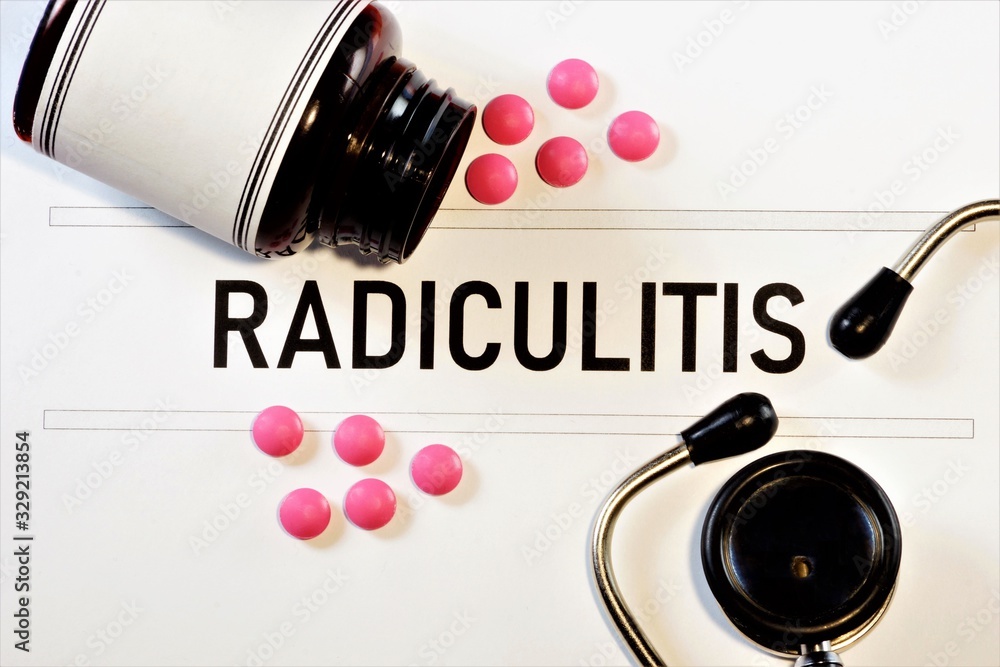 Radiculitis. - an inflammatory disease affecting the nerve roots of the ...