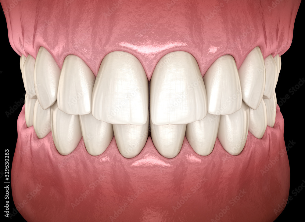 Healthy human teeth with normal occlusion. Medically accurate tooth 3D ...