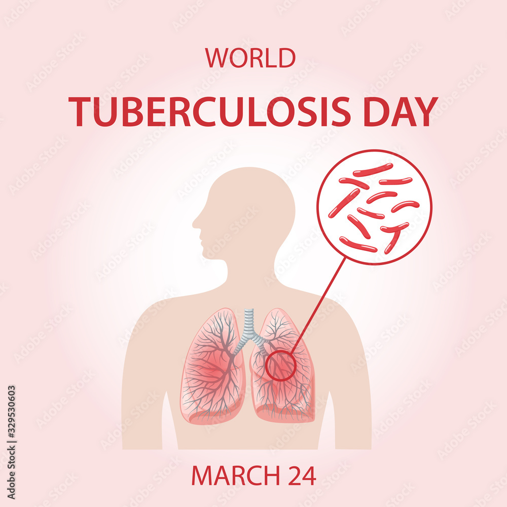 World Tuberculosis Day. Images of human body with sick lungs and Koch ...