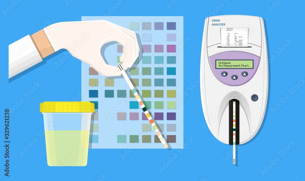 Urine tract exam doctor clinic kidney sick tool pee piss chart color ...