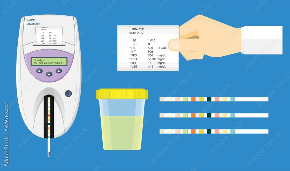 Urine tract exam doctor clinic kidney sick tool pee piss chart color ...