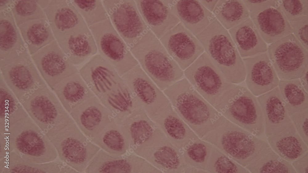 Root tip of Onion and Mitosis cell in the Root tip of Onion under a ...