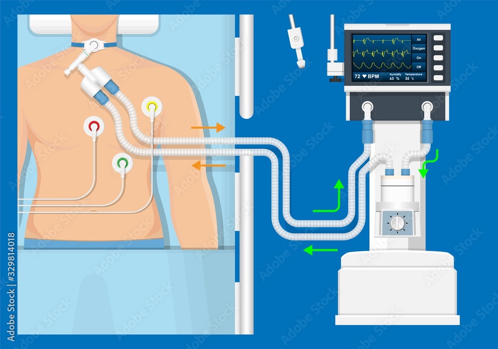 Ventilator Medical Machine Equipment for Tracheostomy Patient Breathing ...