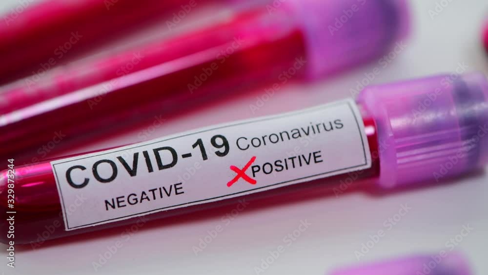 Coronavirus COVID 19 test kits and samples novel corona virus Stock ...