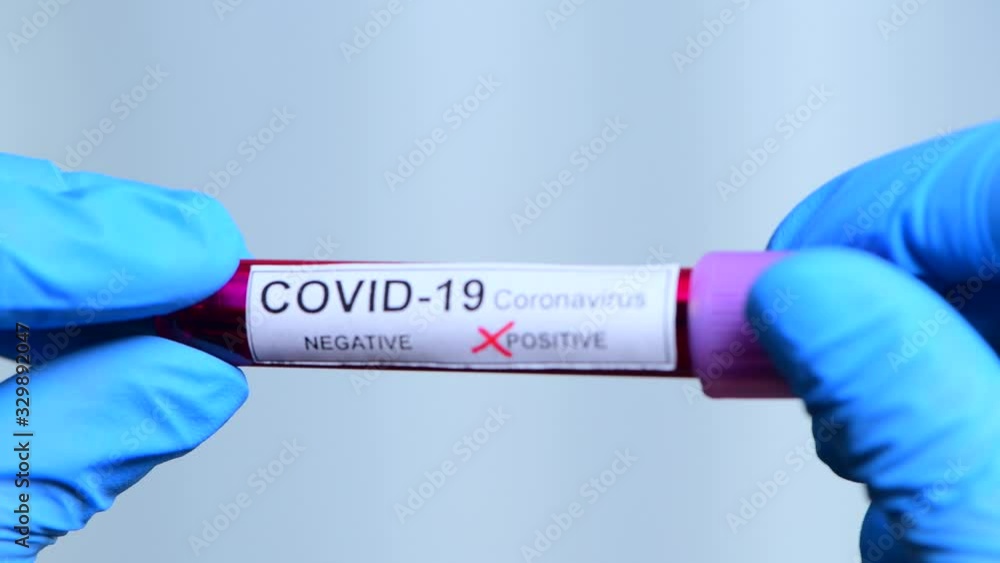 Coronavirus covid 19 test kit corona virus Stock Video | Adobe Stock