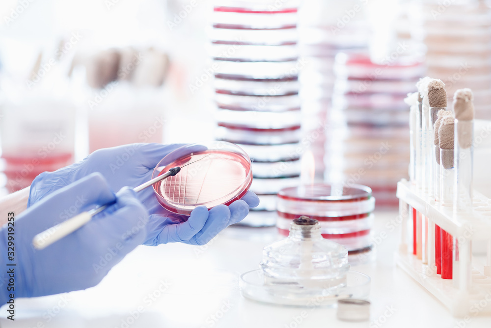 Microbiology laboratory agar plate full of micro bacterias and ...
