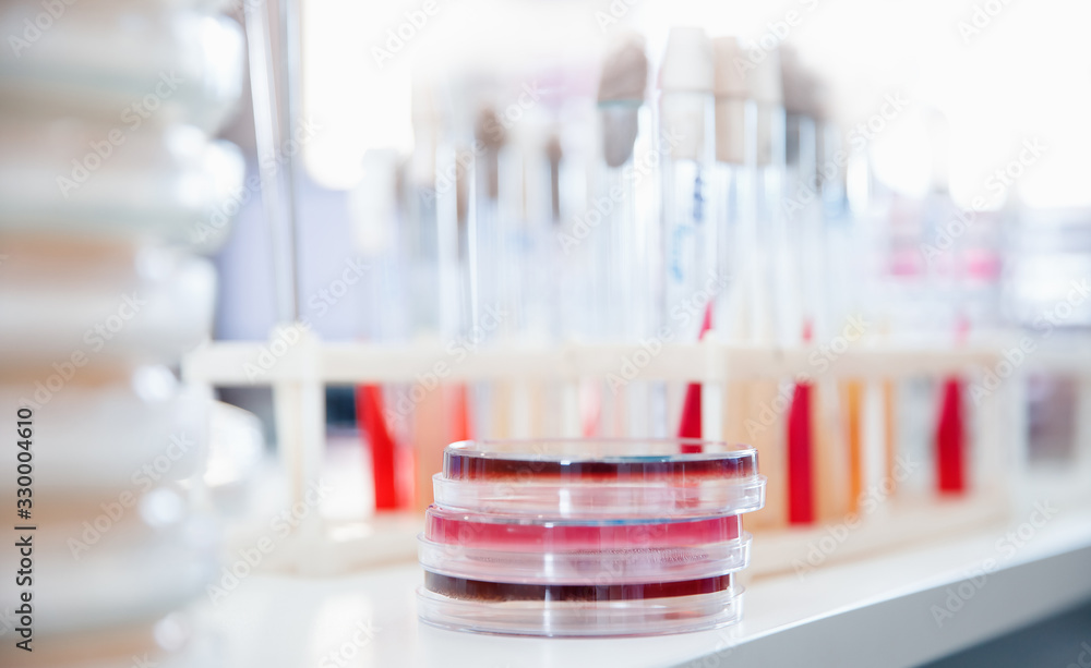 Microbiology laboratory yeast cultivation on agar medium plate, white ...