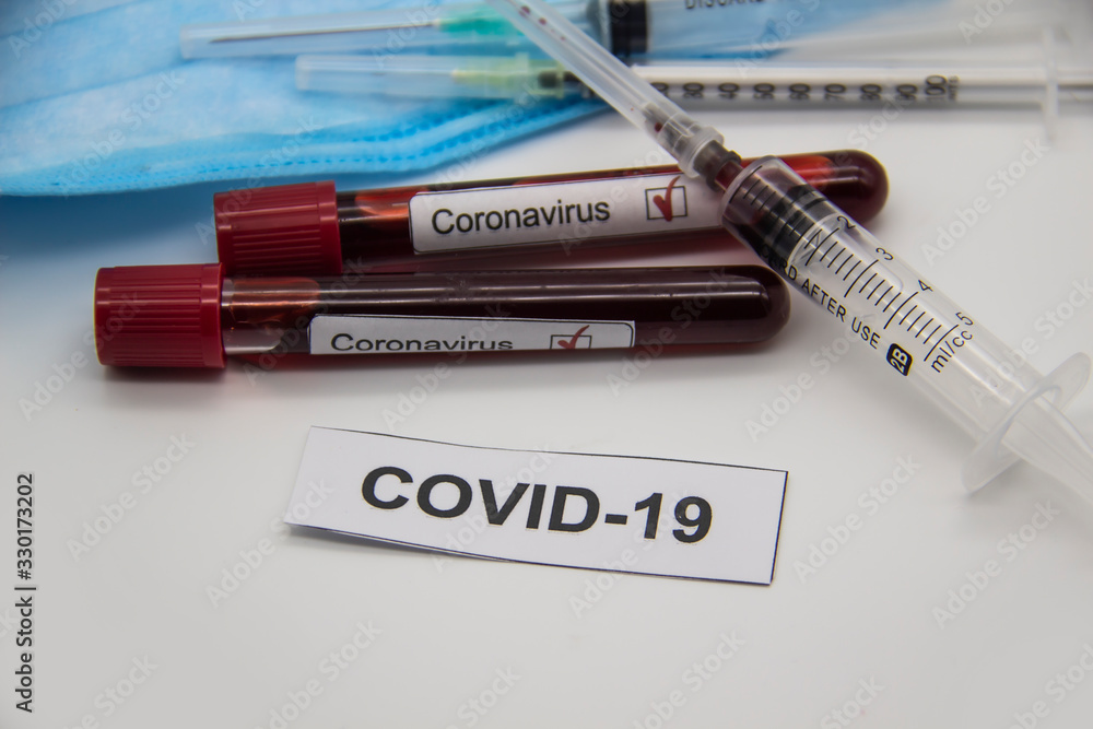 Coronavirus blood test concept. A test tubes with Coronavirus positive ...