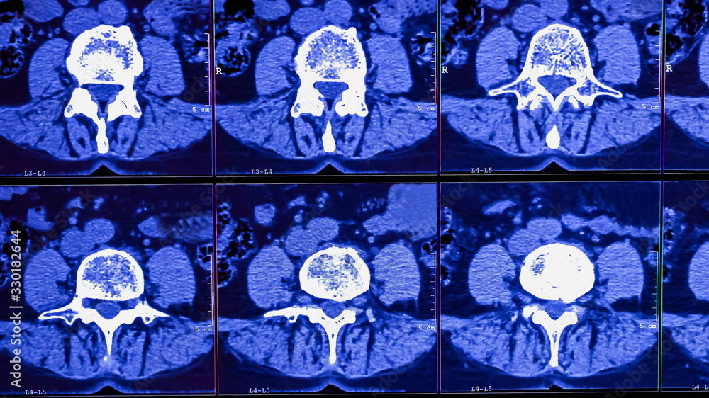 Doctor analyzes the results of computer tomography or CT imaging of ...