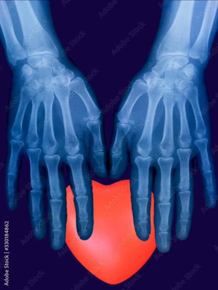 X-ray plate of the bones of the both human hands and red heart sign ...