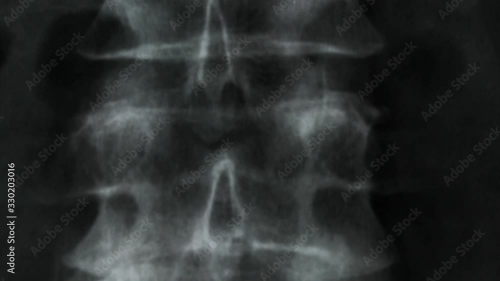 X-ray of the bones of the human vertebral column and pelvis, 4K Stock ...