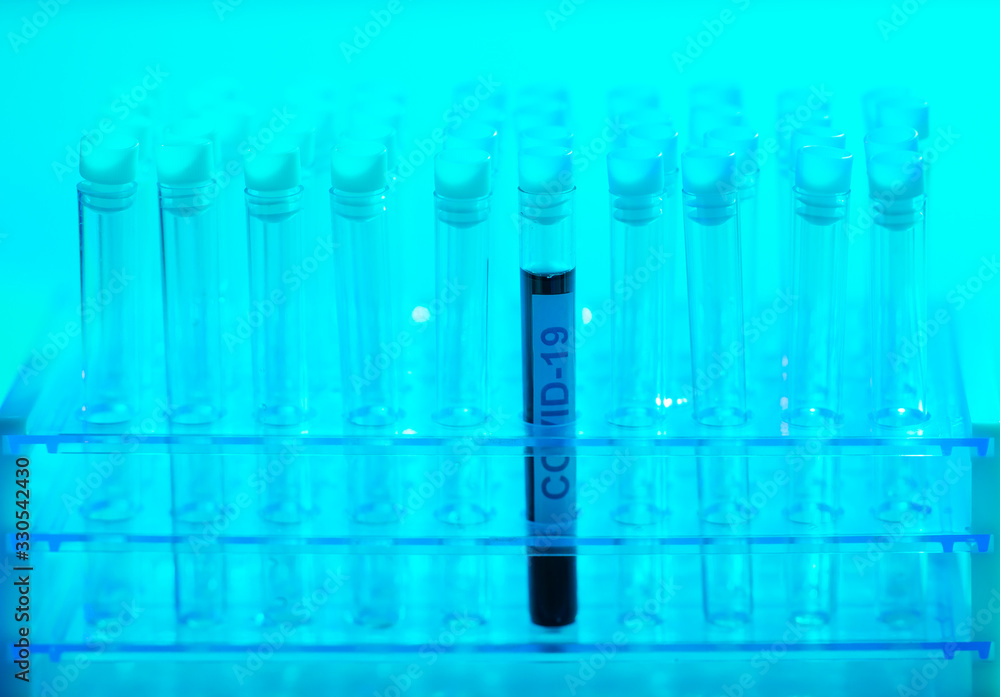 Laboratory tube with blood and virus. Scientific lab close-up. Pandemic ...