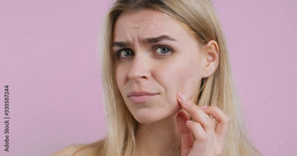 Portrait woman sad face, touches fingers acne problem skin face applies ...