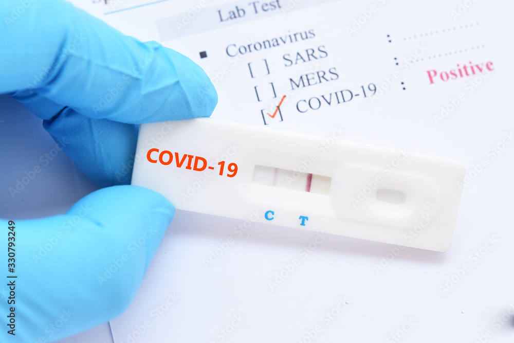 Positive test result by using rapid test device for COVID-19, novel ...