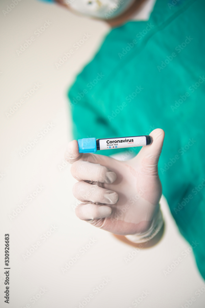 Coronavirus 2019 nCoV Blood Sample Corona Virus Outbreaking Corona coronavirus-2019-ncov-blood-sample-corona-virus-outbreaking-corona
